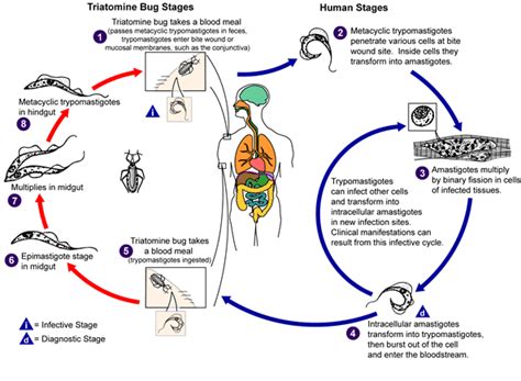 Trypanosomiasis