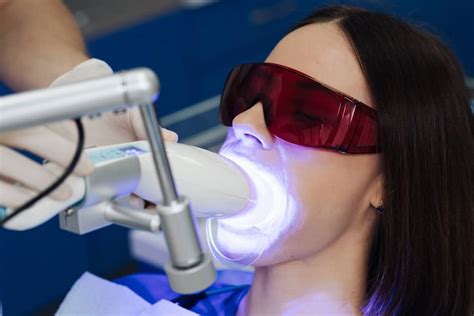 How Long Does Teeth Whitening Last Optismile Advanced Dentistry And