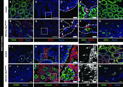 Rac1 Function In Sertoli Cells Is Dispensable For The Maintenance Of Download Scientific