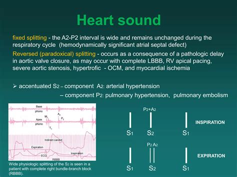 Heart Sound Auscultation Ppt