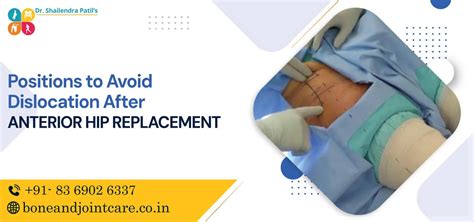 Positions To Avoid After Hip Replacement