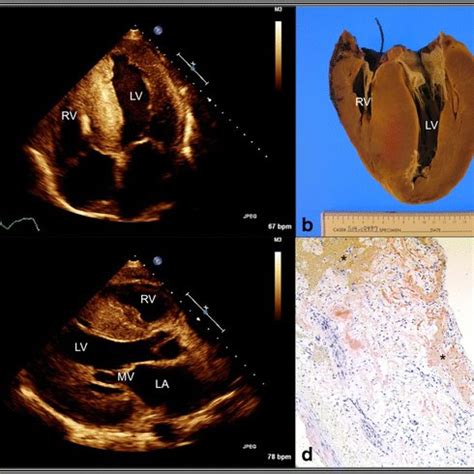 Cardiac Images Showing The Correlation Between Echocardiography And The Download Scientific