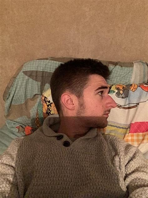What Is A Roman Nose Look Like At Dominic Johnson Blog