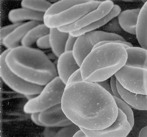 Glóbulos Rojos Eritrocitos Vistos Al Microscopio Sem Eritrocitos Microscopio Eritrocito