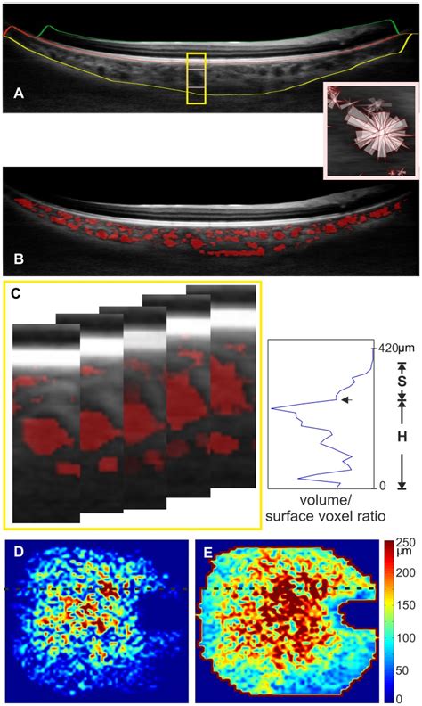 Oct B Scan A Visualizes The Segmentation Lines For The Retina Between Download Scientific