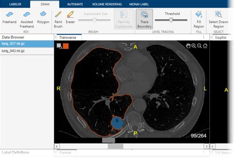 Get Started With Medical Image Labeler MATLAB Simulink
