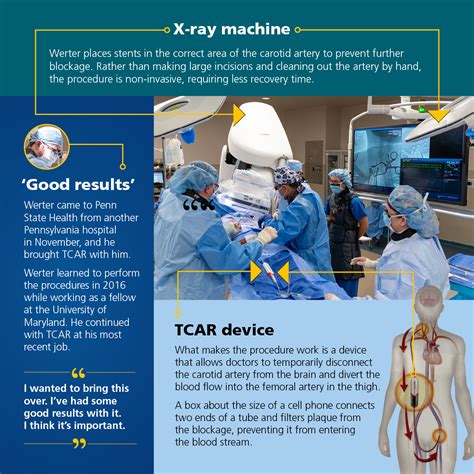 Carotid Tcar Procedure Tcar Guidelines Uieb