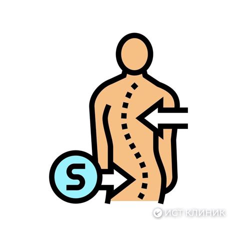 Лечение S образного сколиоза в Москве Остеопатия Остеопат Сколиоз 1 2 3 4 степени