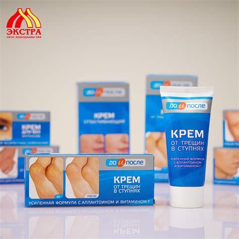 Экстра ХӨЛИЙН ӨСГИЙНИЙ ХАГАРАЛТ ЭМЧЛЭГЧ ТОС 50мл🦶 🔰🔰🔰 Барааны код 246198 ҮНЭ 5 780₮🛒🛒🛒 🔹🔹🔹🔹