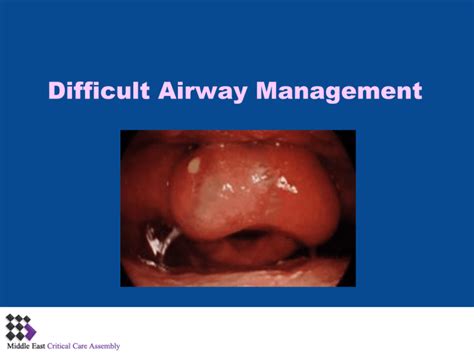 Difficult Airway Management Evaluation And Rescue Tools