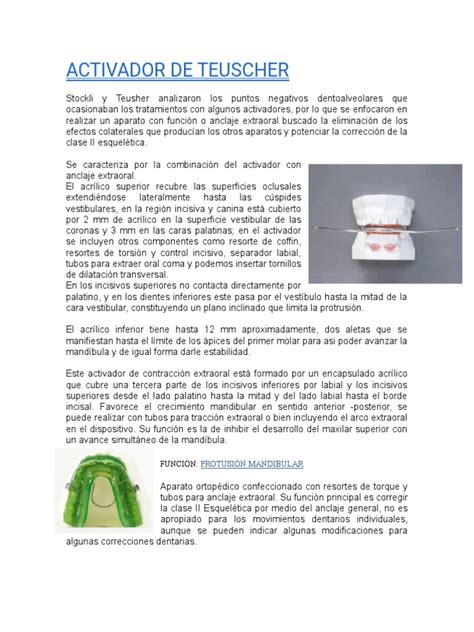 El Activador De Teuscher Un Aparato Ortopédico Con Anclaje Extraoral Para Corregir La
