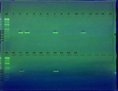 Mycobacterium Avium Subsp Paratuberculosis Specific Amplicons 314 Bp Download Scientific