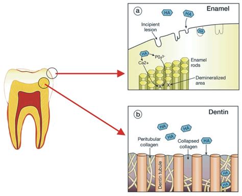 Hydroxyapatite In Oral Care Products—a Review