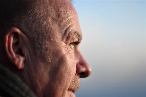 What Is A Macular Pucker Scar Tissue On The Macula Associated Retina Consultants