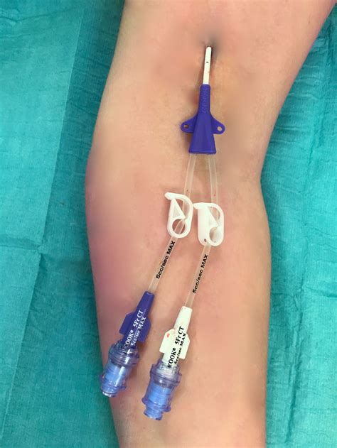 Iv Infusion Picc Line