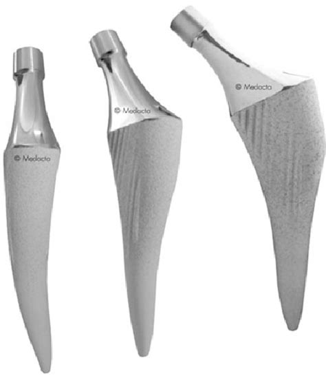 Figure 1 From Successful Reconstruction Of Natural Femoral Anteversion Using A Short Femoral
