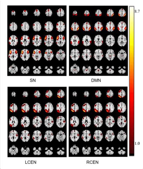 The Spatial Distribution Of Components In Sn Dmn Left Cen And
