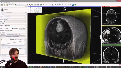 Model From Ct Scan At Martha Stull Blog