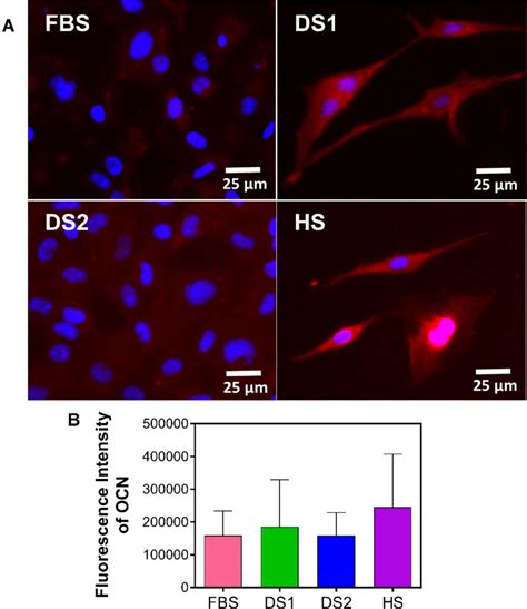 Immunofluorescence Of Ocn Expression In Mc3t3 E1 Cells Cultured For 21
