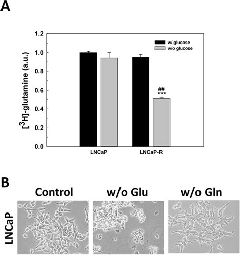 Glut1 Protects Prostate Cancer Cells From Glucose Deprivation Induced Oxidative Stress Pmc