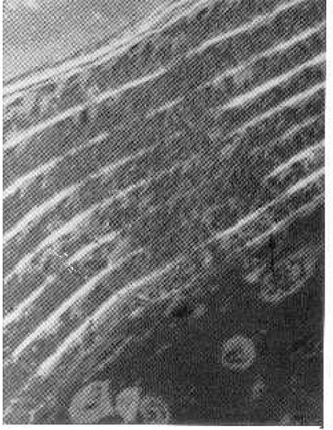 1 Rhythmic Deposition Of Chitin Layers In The Tibia Of A Cockroach