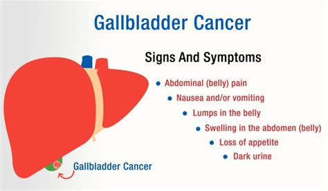 Prolife Cancer Treatment Gallbladder Cancer Treatment In Pune Dr