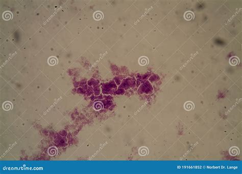 Streptococcus Lactis