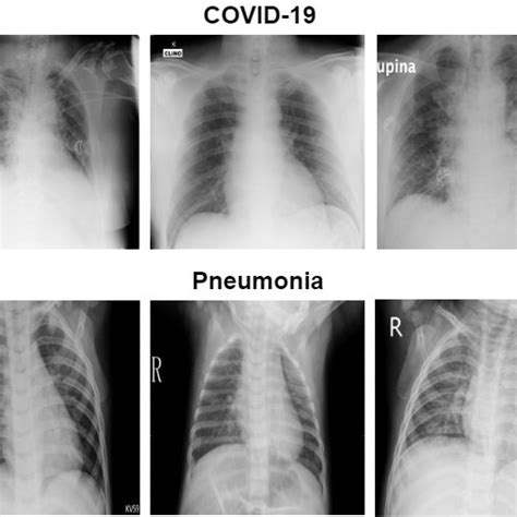 Pdf Data Augmentation Using Generative Adversarial Networks Gans For Gan Based Detection Of