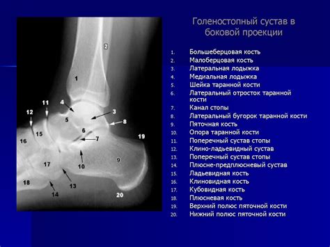 Нормальная рентгенанатомия конечностей и суставов Диагностика изменений позвоночника у