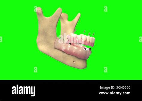 3 D Illustration Of A Tooth Anatomy Stock Video Footage Alamy