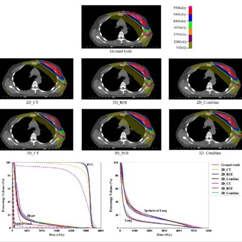 Framework Of Dose Distribution Prediction Using U Net Download Scientific Diagram
