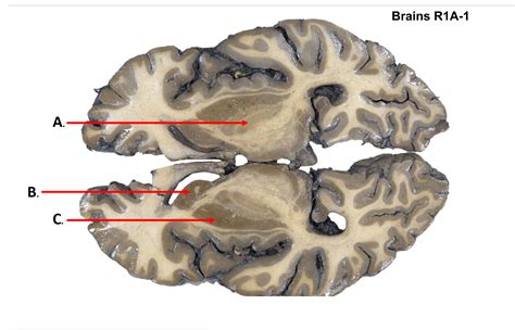 Identify The Structures Labelled A B And C Chegg