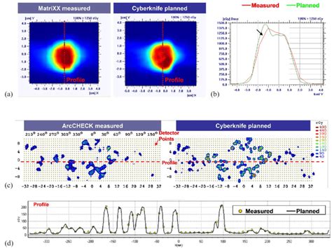 The 2d Dose Comparisons And The Profile Dose Comparisons Between The Download Scientific