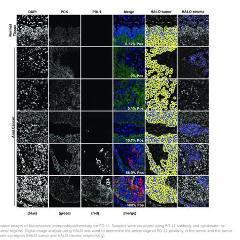 Pediatric Conduction And Rhythm Disorders De Tected Through Ecg And 24