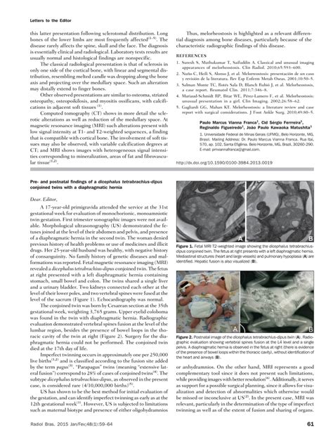 Pdf Pre And Postnatal Findings Of A Dicephalus Tetrabrachius Dipus Conjoined Twins With A