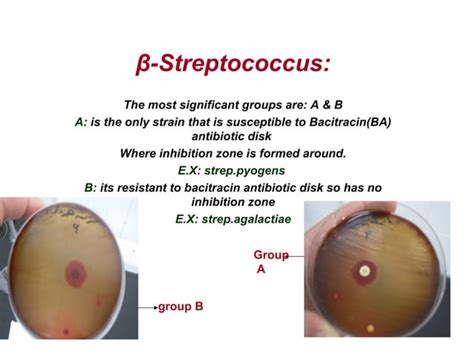 Staphylococcus Streptococcus PPT Blood Disorders Diseases And Conditions