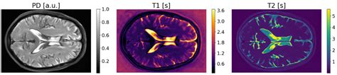 논문 리뷰 Physics Informed Latent Diffusion for Multimodal Brain MRI Synthesis