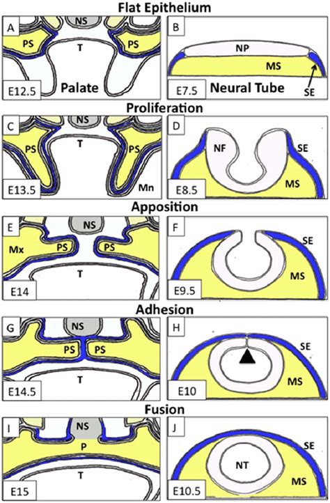 Analogous Processes In Palate And Neural Tube Development First