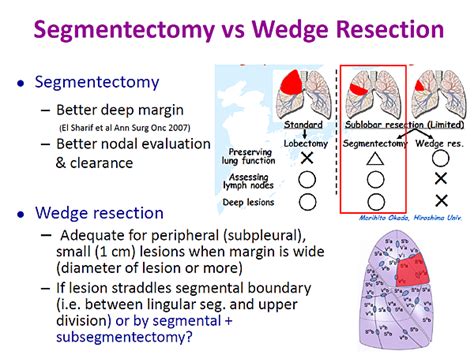 Cs Surgery－醫學筆記匯整 Ed Notes｜痞客邦