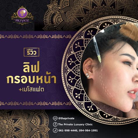 โปรโมชั่นเดือนตุลาคม 🎉🎉 หน้าเรียวขั้นสุด Botox ลิฟกรอบหน้า เมโสแฟต8 999 💉 Botoxกราม เมโสแฟต
