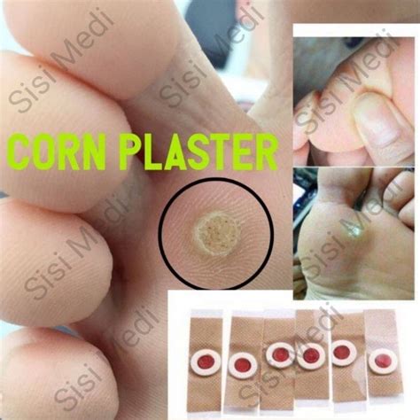 Plaster Ketuat Corn Wart Plaster 6pcs Shopee Malaysia