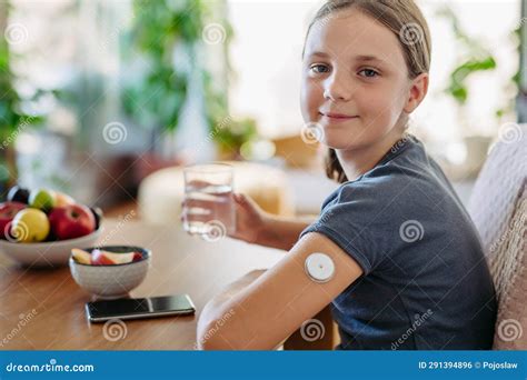 Close Up Of Continuous Glucose Monitor Sensor On Girl S Arm Stock