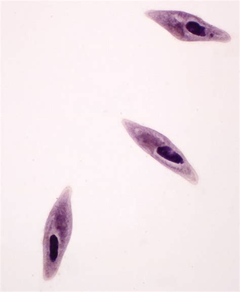 Paramecium Caudatum Wm Microscope Slide Southern Biological Paramecium Caudatum Wm Microscope Slide Southern Biological