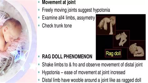 Approach To Floppy Infant Pptx