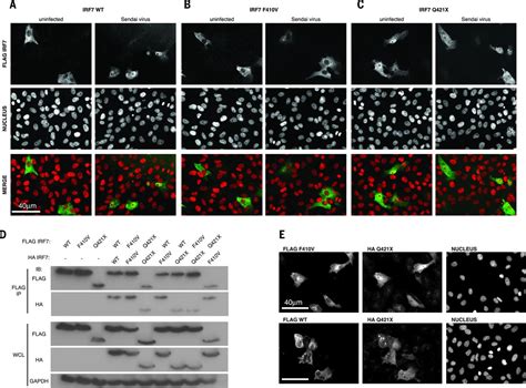 Life Threatening Influenza And Impaired Interferon Amplification In