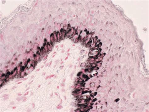 Rapid Fontana Masson Staining