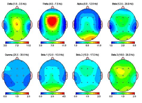 Qeeg Brain Wellness And Biofeedback Center