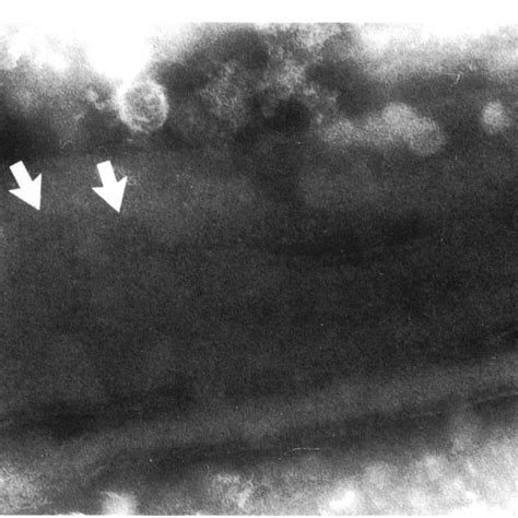 Negative Staining Of A Cell Wall Fragment Obtained By Sonication Of P