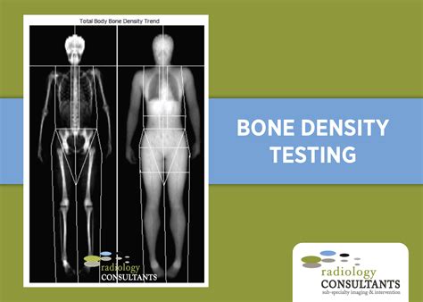 Bone Density Testing — Radiology Consultants