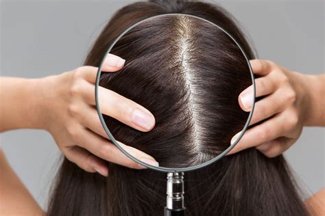 6 Tips To Keep Your Scalp And Hair Healthy Terra Medical Clinic Singapore